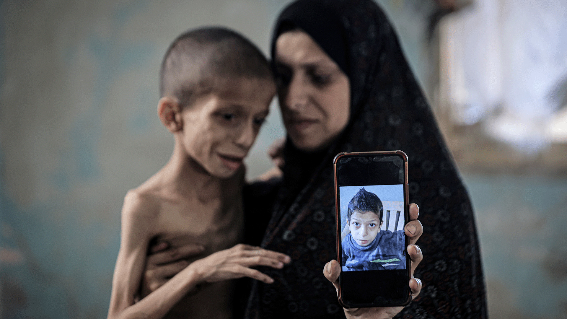 The humanitarian crisis in Gaza is exacerbated by a severe ...